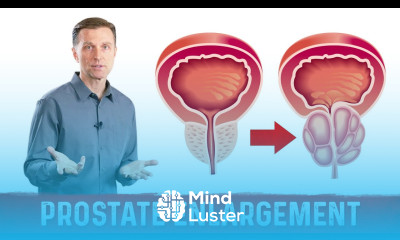 Learn The Real Cause of Prostate Enlargement – Dr Berg - Mind Luster