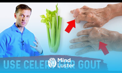 Learn Celery Benefits for Gout – Dr Berg - Mind Luster
