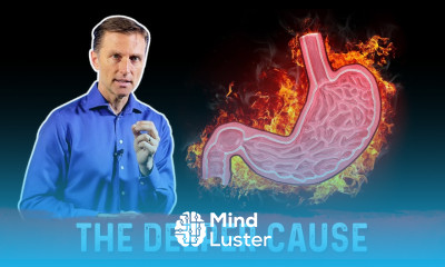 Learn The Real Causes of Acid Reflux Heartburn GERD – Dr Berg - Mind Luster