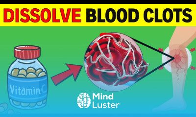 Learn TOP 6 Best VITAMINS To Help Dissolve BLOOD Clots In Your BODY ...