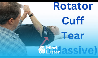 Learn Massive Rotator Cuff Tear Classic signs - Mind Luster