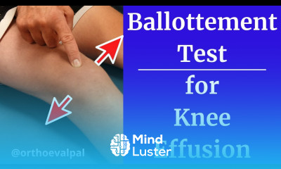 Learn Ballottement Test for Effusion in the Knee - Mind Luster