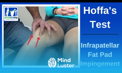 Learn Hoffa s Test for Infrapatellar Fat Pad Syndrome - Mind Luster