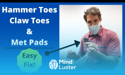 Learn Hammer Toes Claw Toes and Met Pads Easy Fix - Mind Luster