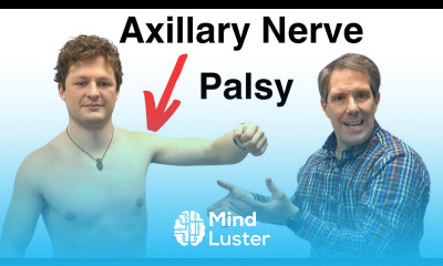 Learn Signs of Axillary Nerve Palsy - Mind Luster