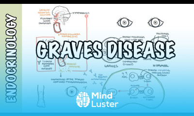 Learn Graves Disease Overview causes pathophysiology investigations and ...