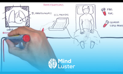 Learn Acute Coronary Syndrome DETAILED Overview MI STEMI NSTEMI - Mind ...