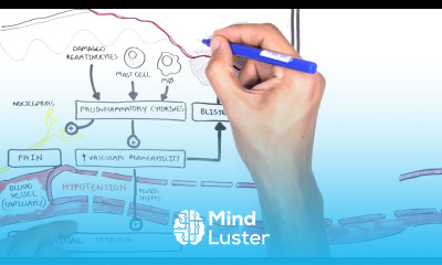 Learn Burns DETAILED Overview Types Pathophysiology TBSA - Mind Luster
