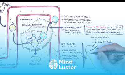 Learn Epstein Barr Virus and Infectious Mononucleosis pathophysiology ...