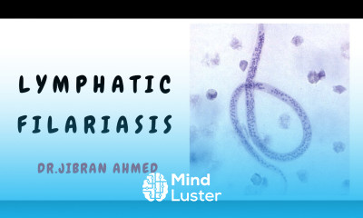 Learn LYMPHATIC FILARIASIS II INFECTIONS II SIMPLY PATHOLOGY II POST ...