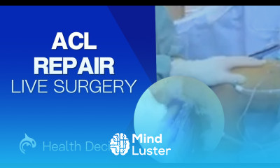 Learn ACL Repair Live Surgery and Narration - Mind Luster