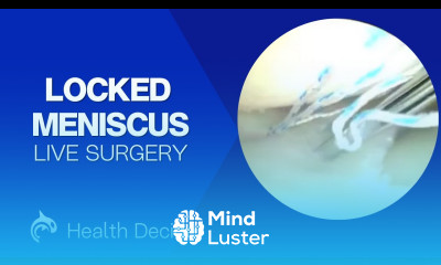 Learn Locked Meniscus Repair Live Arthroscopic Knee Surgery - Mind Luster
