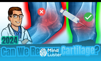 Learn Can We Reverse Arthritis Regrow Cartilage New Studies - Mind Luster
