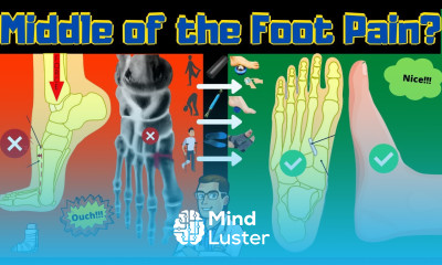 Learn Lisfranc Injury Treatment Recovery Time Middle Foot Pain CURE ...