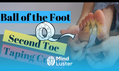 Learn 2nd Toe Pain Capsulitis Ball of Foot Taping 2022 Home Treatment ...