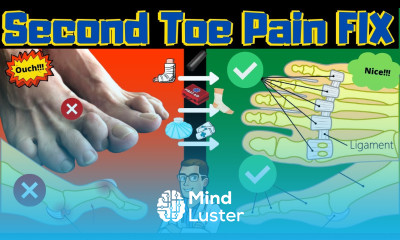 Learn Second Toe Pain TREATMENT Capsulitis Taping Freiberg Disease FIX ...
