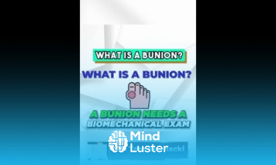 Learn Bunion vs Arthritis Big Toe Joint Arthritis Surgery Hallux ...