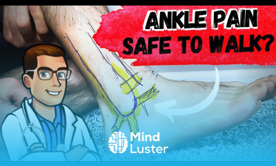 Learn Can You Walk on a Sprained Ankle Rolled Ankle Sprain Recovery ...