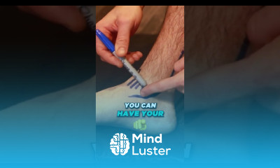 Learn What is SPRAIN Injury what is a Twisted Ankle - Mind Luster