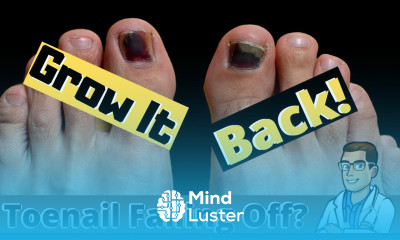 Learn Why are my Toenails Falling Off Toenail Regrowth After Falling ...