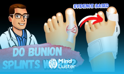 Learn Do Bunion Correctors Work How To SHRINK Bunions Naturally - Mind Luster