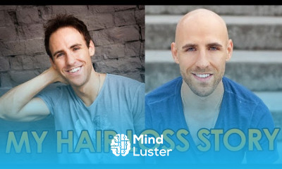 Learn My Hair Loss Story Going Bald Early Advice - Mind Luster