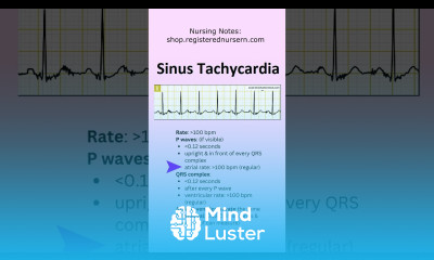 Learn Sinus Tachycardia EKG ECG Rhythm Nursing Review in 60 Seconds ...