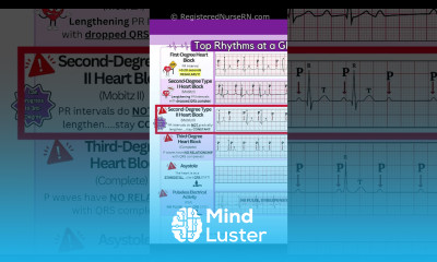 Learn ECG EKG Rhythms to Know Sinus Rhythms Sinus Tachycardia Heart blocks etc - Mind Luster