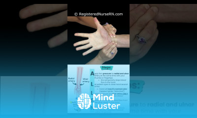 Learn Modified Allen Test Demonstration Nursing Mnemonic nursing nurse ...
