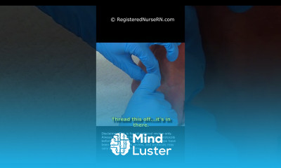 Learn IV Insertion Technique in Hand Cannulation Nursing Tips in Less Than 60 Seconds shorts ...