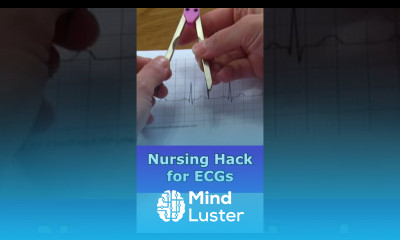 Learn Nursing Hack for ECG Interpretation Calipers shorts Nurse Hacks ...