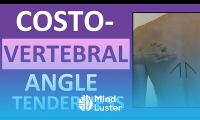 Learn Costovertebral Angle Tenderness Exam CVA Percussion Assessment ...