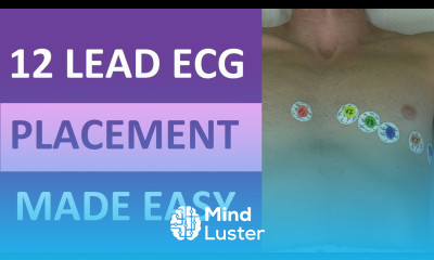 Learn 12 Lead ECG Placement Made Easy Nursing EKG Electrodes Interpretation - Mind Luster